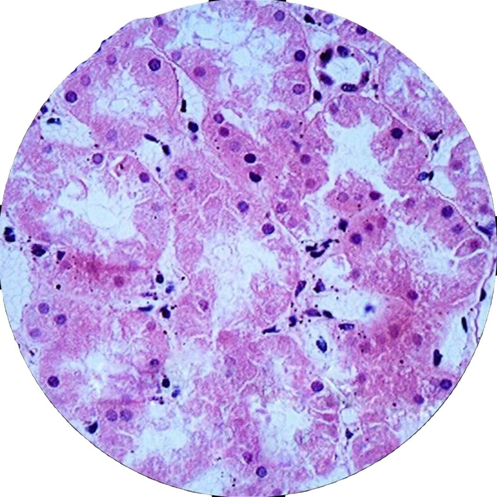 Fixed Set 50 Kinds Human Pathology Microscope 100 pcs medical ...