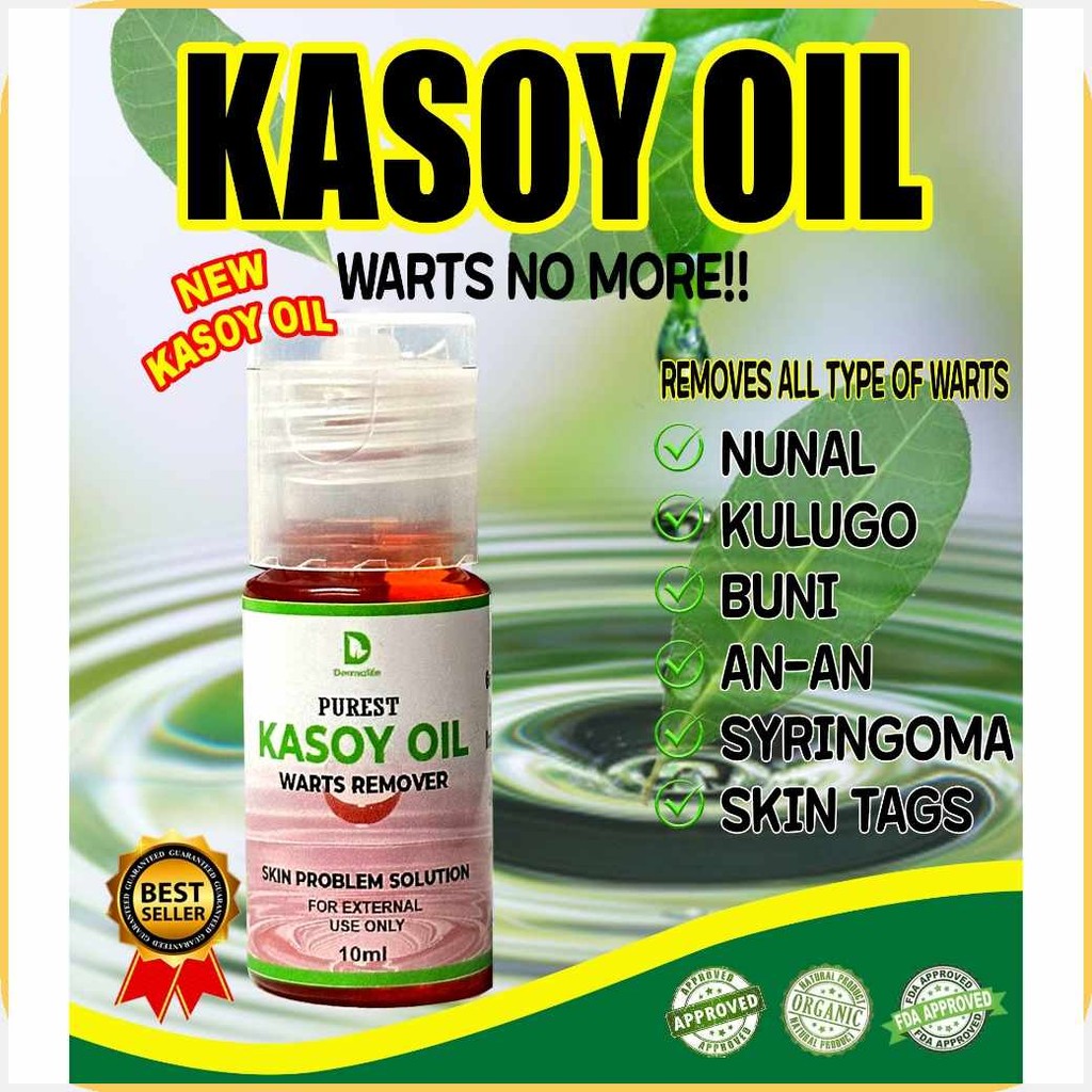 KASOYj%OIL=UT%ORIGINAL@A+KULUGO GN+wj+sj+r+K+SYRINGOMA SKIN TAGS WARTS ...
