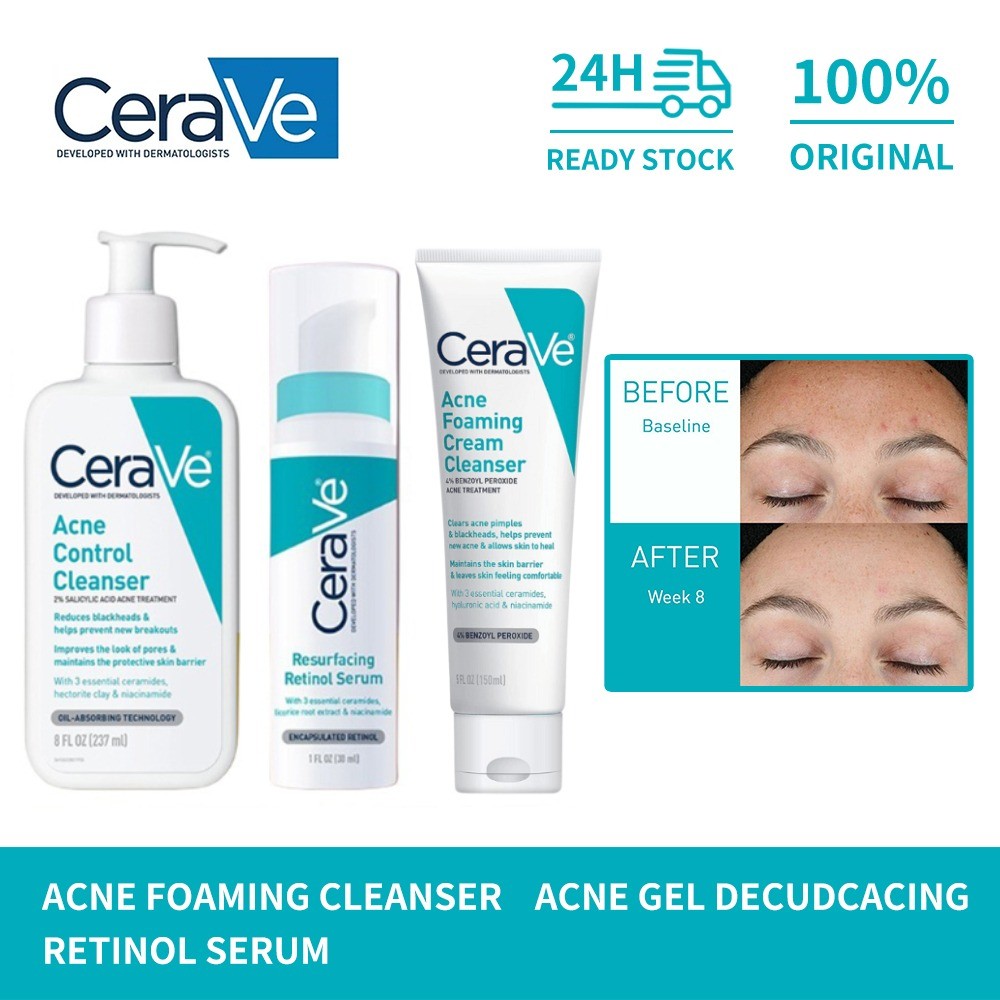 cerave official store PH Acne Foaming Cream Cleanser| Acne Control ...