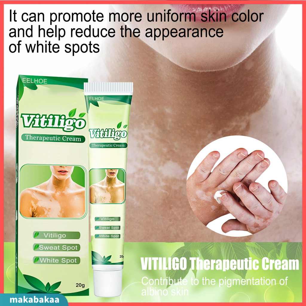 (makabakaa) 20g White Tag Cream Unique Easy to Use Plant Extracts ...