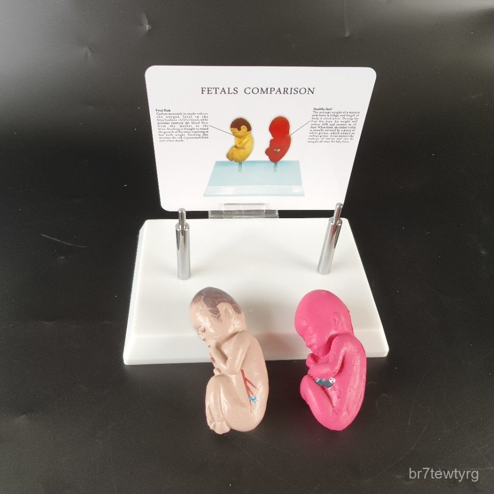 DWLA Human Body Demonstration Fetal Simulation Internal Organs Teaching ...