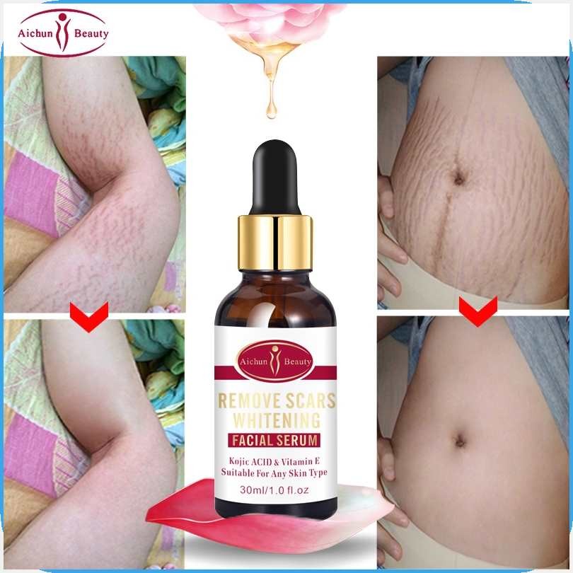 Stretch]i?marks#B*remover,AN