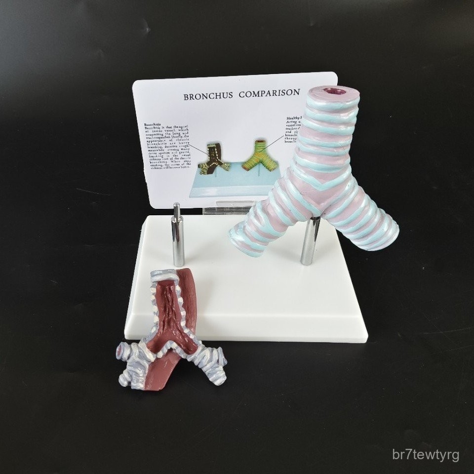 LJK7 Trachea Anatomy Comparison and Smoking System Model Trachea ...