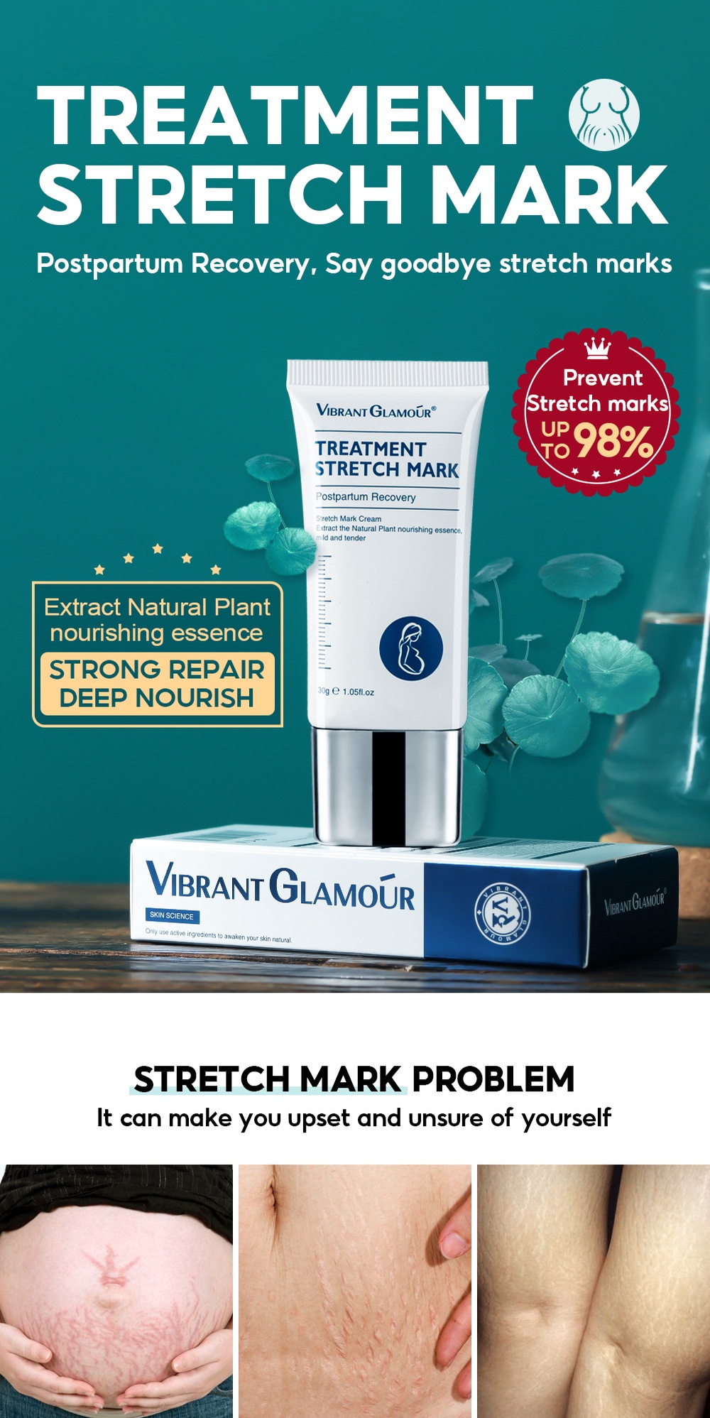 VIBRANT GLAMOUR Pregnancy Stretch Marks Remover Cream Body Care 30g ...
