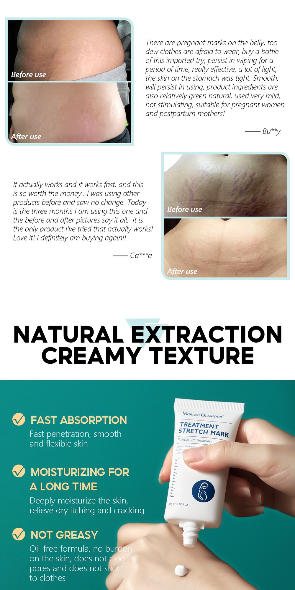 VIBRANT GLAMOUR Pregnancy Stretch Marks Remover Cream Body Care 30g ...