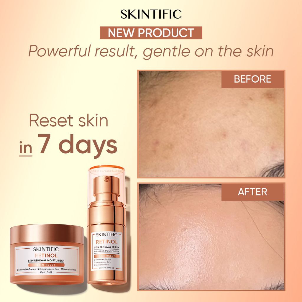 [Anti-aging]SKINTIFIC Retinol Skin Renewal Moisturizer 30g Skin Care ...