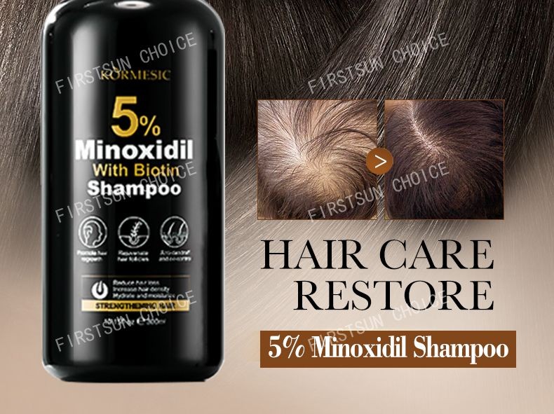 Minoxidil 5% Hair Grower with Biotin Shampoo And Conditioner 300ml ...