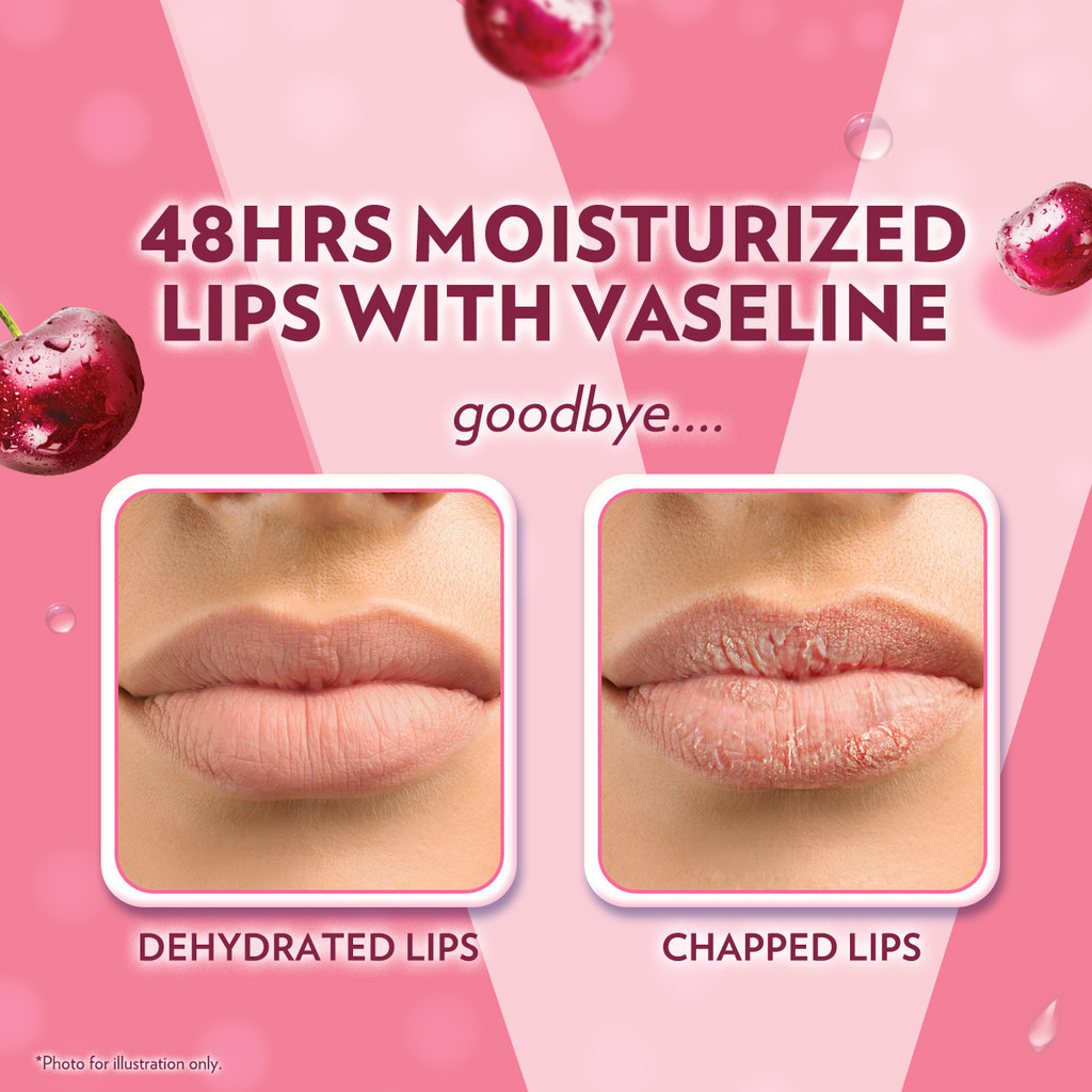 Vaseline Lip Cherry Blush Lip Balm Stick 4.8G | Shopee Philippines