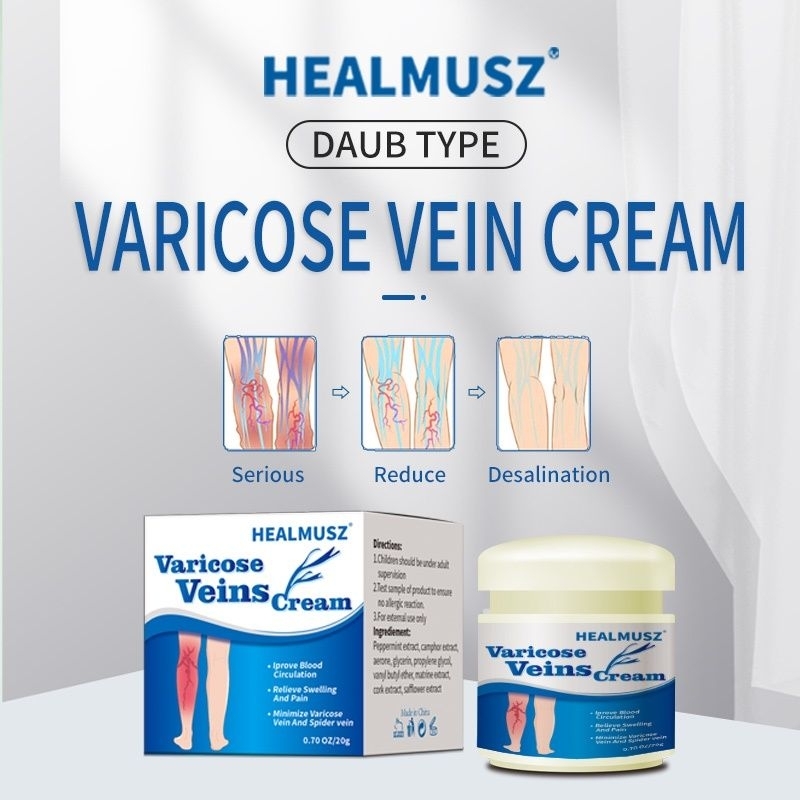 Healmusz Varicose Treatment Cream for Relieving Vascular Swelling of ...
