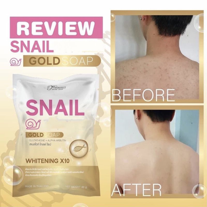 Perfect Skin Lady Snail Gold Soap With Free Net ( FDA PHILIPPINES ...