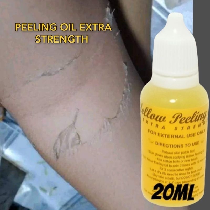 YELLOW PEELING OIL EXTRA STRENGTH 15ml | Shopee Philippines