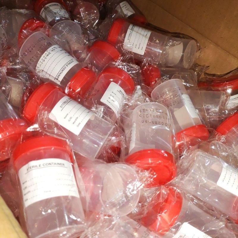 sterile specimen cups with scooper individually packed 250 pcs-1 box ...