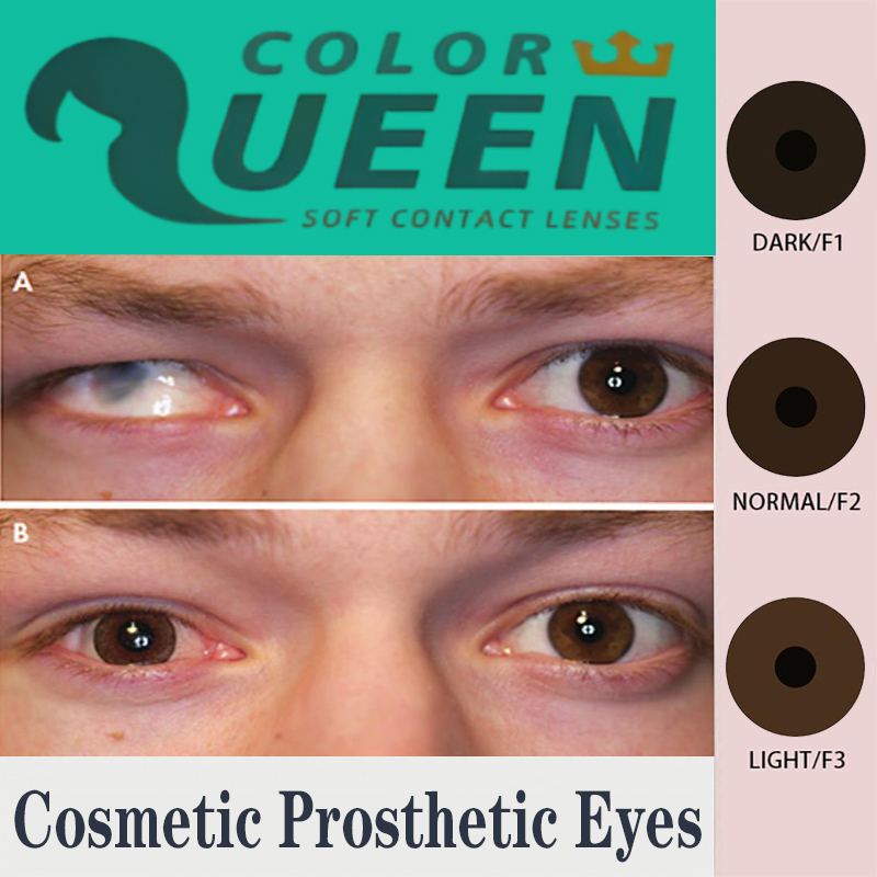 Color Queen Prosthetic Contact Lens Eye Defects Iris Lenses aesthetic lenses Lens for People ...