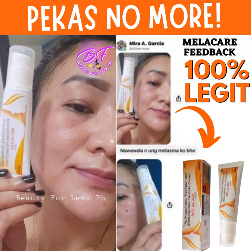 AUTHENTIC MelaCare Pekas remover dark spot pekas eraser melasma eraser ...