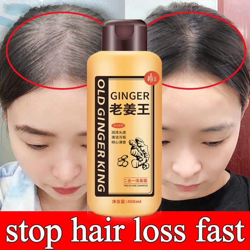 Ginger Shampoo Fast Regrowth Hair Anti Hair Loss Anti Dandruff Anti Itching Hair Thick Shampoo