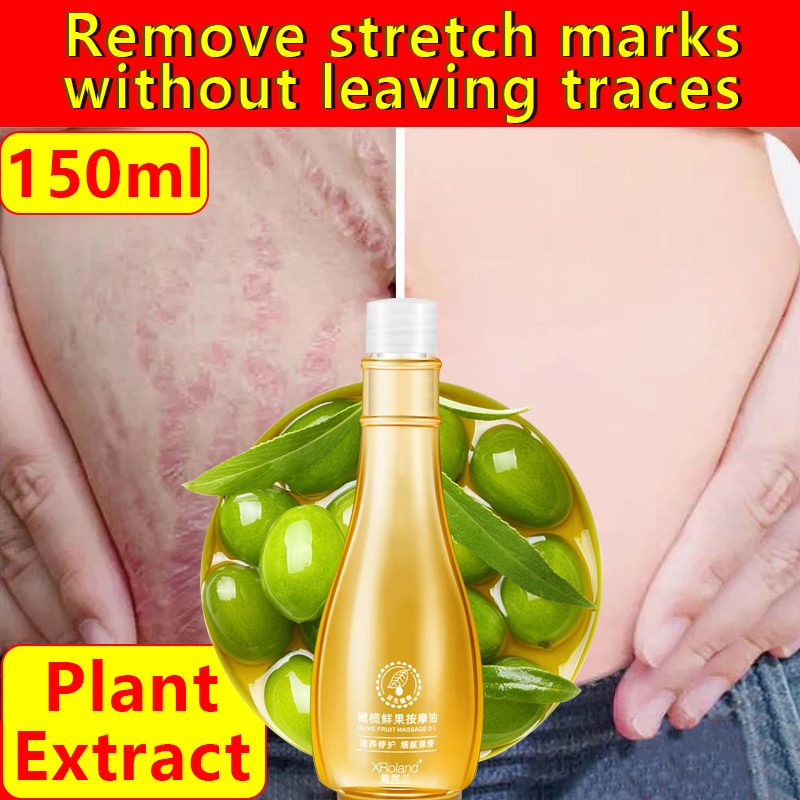 Stretch mark remover 150ml Anti-Stretch mark remove postpartum stretch ...