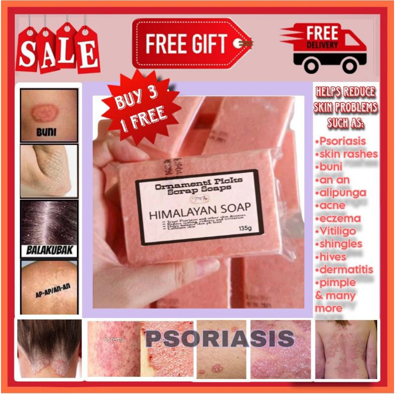 Himalayan treatment soap Anti-bungang araw soap/ prickly heat Rash Soap ...