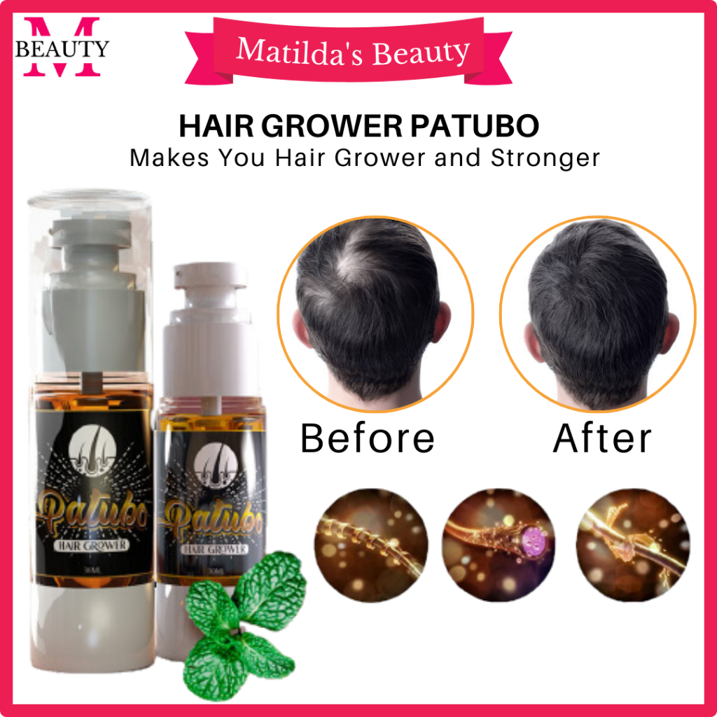 Patubo Hair Growth Essential Hair Loss Treatment Prevent Baldness Beard ...