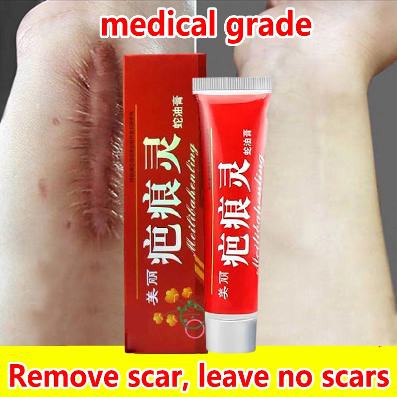 Original Scar Removal For Old Scar Peklat Remover Cream Acne Marks ...