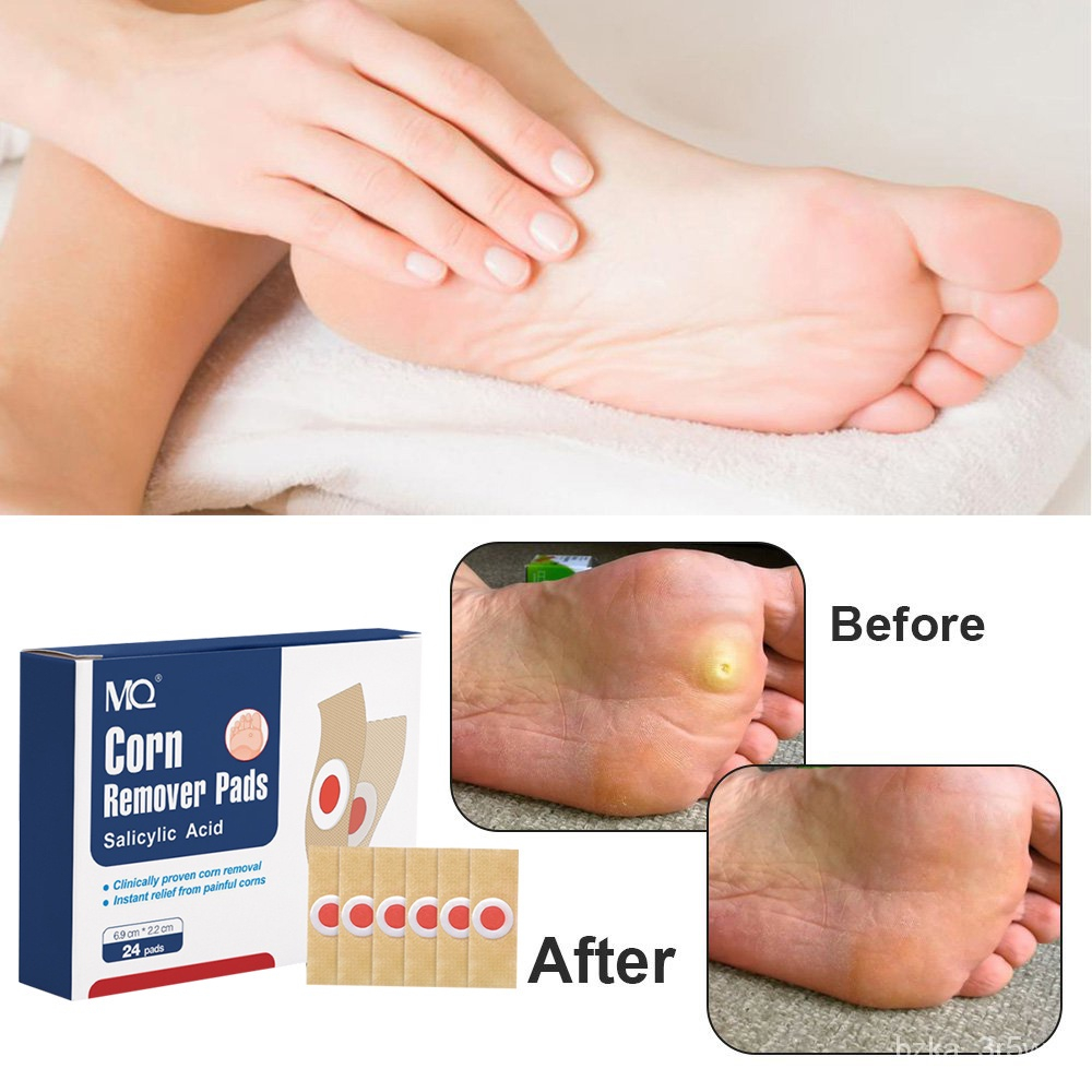 Foot Care Stickers Medical Plaster Chicken Eye Corns Patches Warts ...