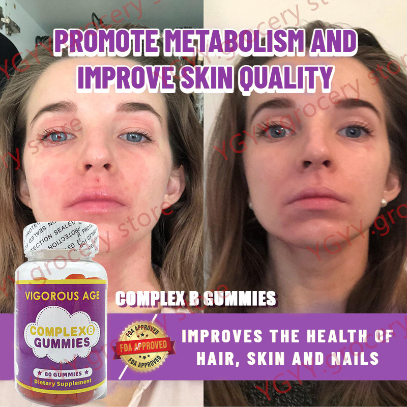 Vitamin B Complex Gummies Vitamin C Immunity Relieve Anxiety Sleep Improve Muscle Weakness ...