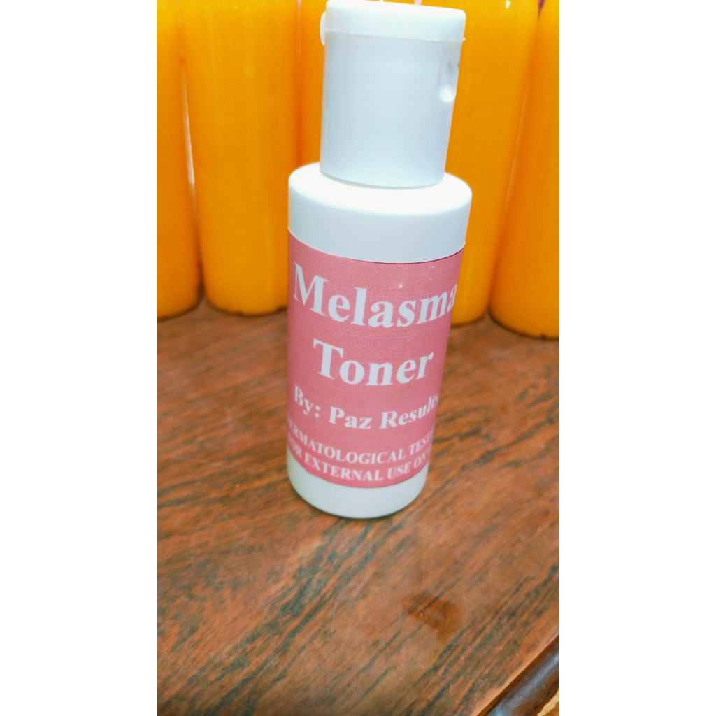 ANTI-MELASMA Toner 60ml for All Skin Types | Shopee Philippines