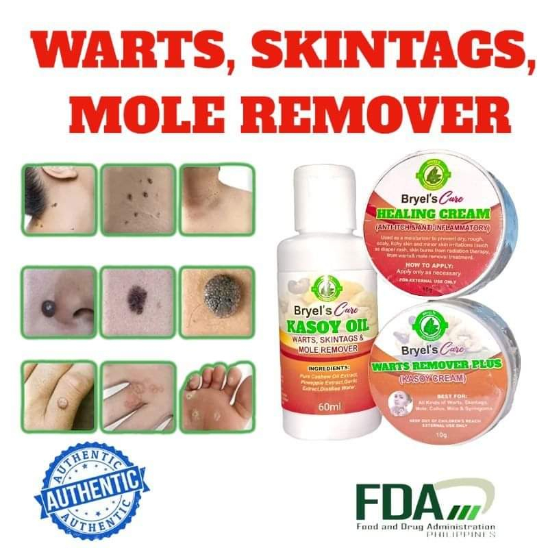 SET 3 IN 1 WARTS REMOVER CREAM AND KASOY OIL W/ HEALING CREAM,SKINTAGS ...