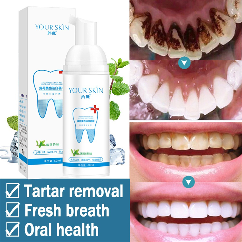 YANJIAYI Teeth Whitening Mousse Toothpaste Remove Plaque Stains Care ...
