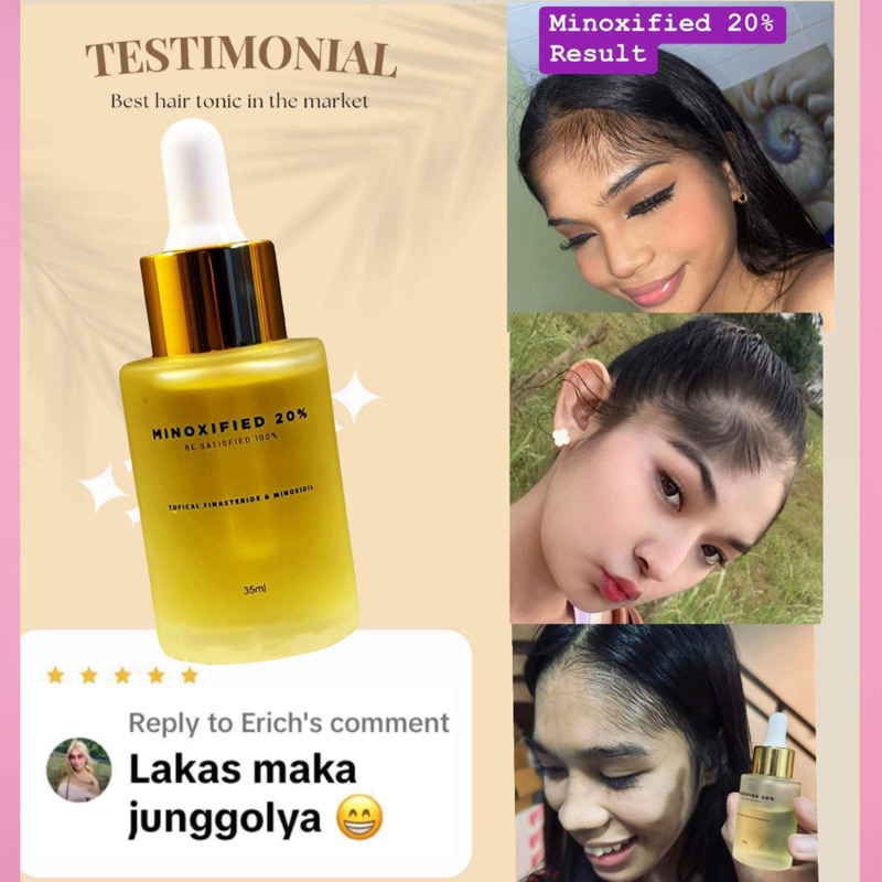 𝐌𝐈𝐍𝐎𝐗𝐈𝐅𝐈𝐄𝐃 20% 𝐇𝐀𝐈𝐑 𝐆𝐑𝐎𝐖𝐄𝐑 - 𝐀𝐲𝐚 𝐁𝐞𝐚𝐮𝐭𝐢𝐪𝐮𝐞 | Shopee Philippines