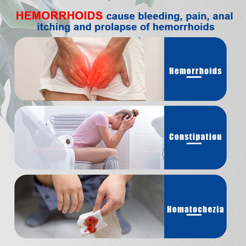 Hemorrhoids Ointment Treatment Gamot Sa Almoranas Herbal Essences ...