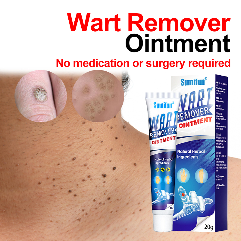 【Safe Ingredients】Gamot Sa Kulugo Warts Remover Original Skin Tag ...
