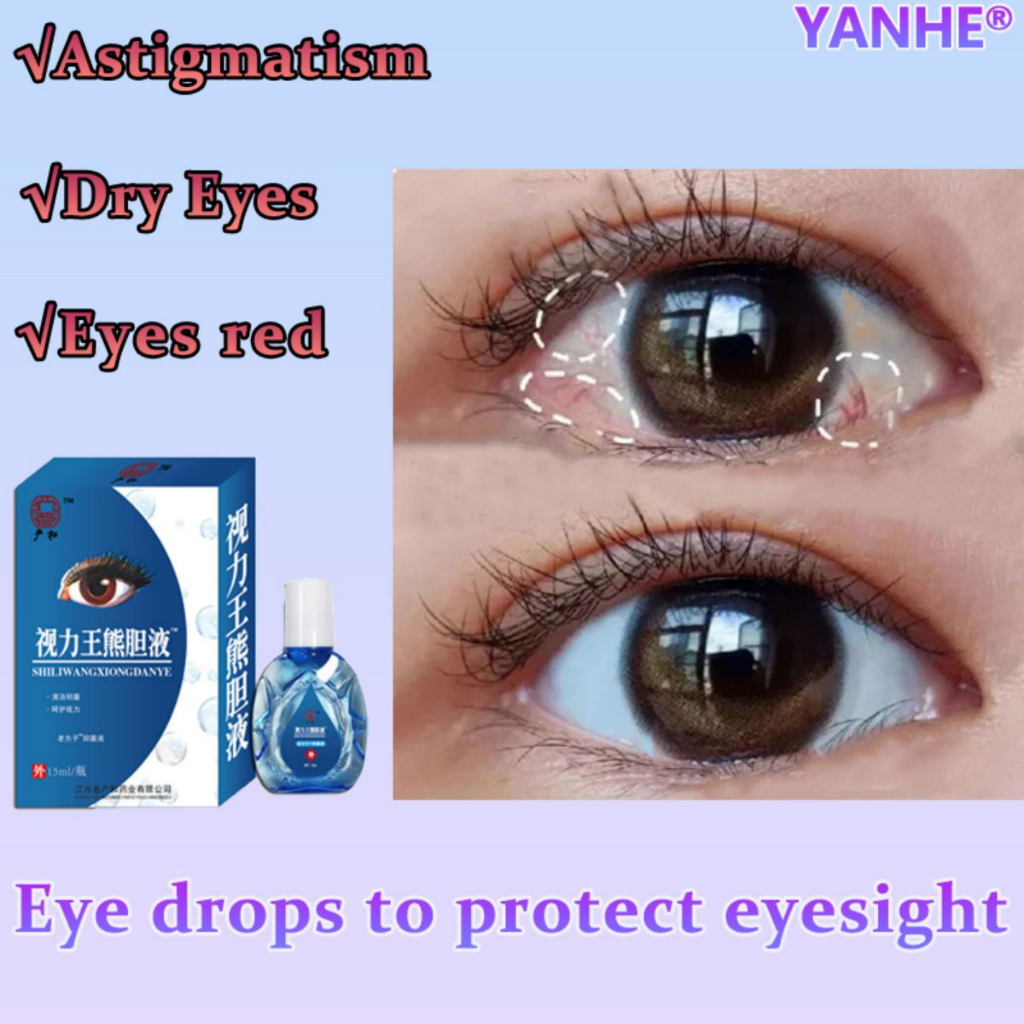 【YANHE】eye drops Relieve visual fatigue and pseudomyopia nourishing ...