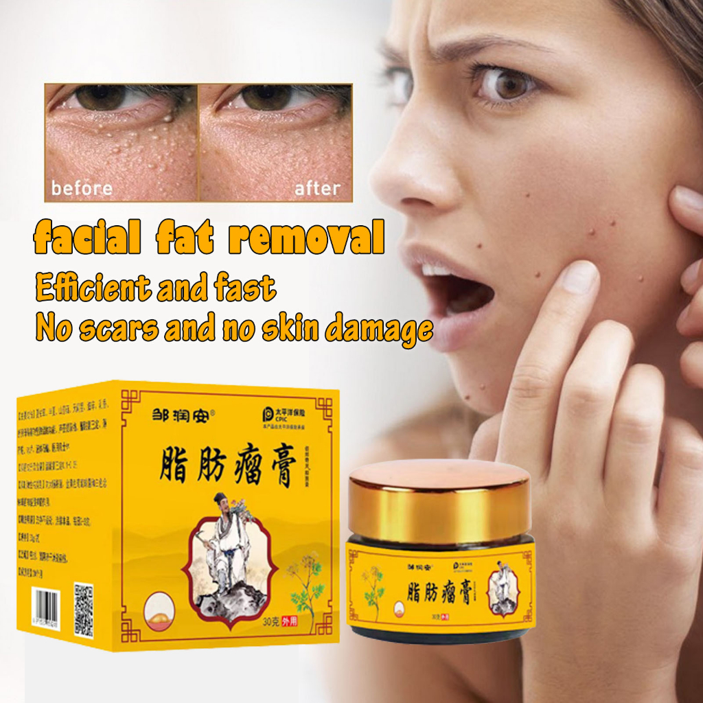 50g lipoma cream 2.0 bukol removal cream original ginger cream for bukol ointment bukol sa leeg ...