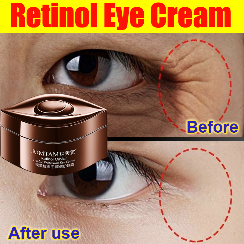 Retinol Eye Cream Caviar Eyebag Remover Cream Anti Wrinkle Anti Aging ...