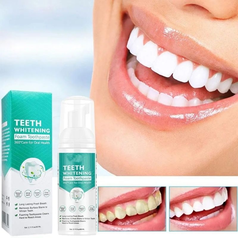 Foam Toothpaste Stain Removal Teeth Mouth Clean Toothpaste Whitening ...