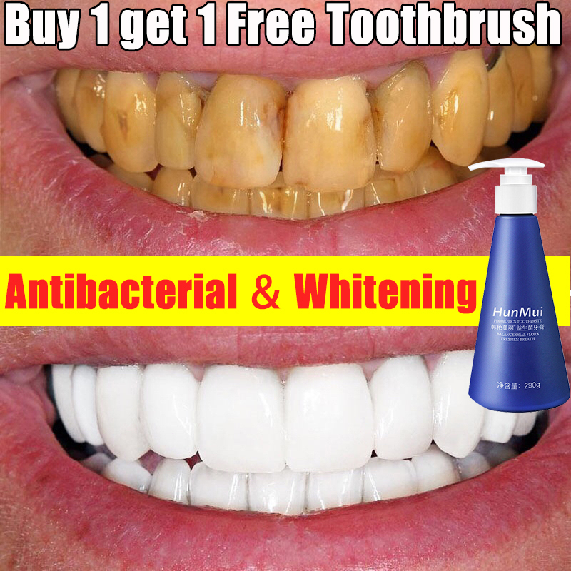 Whitening toothpaste Probiotics teeth whitening 290g Teeth whitening ...