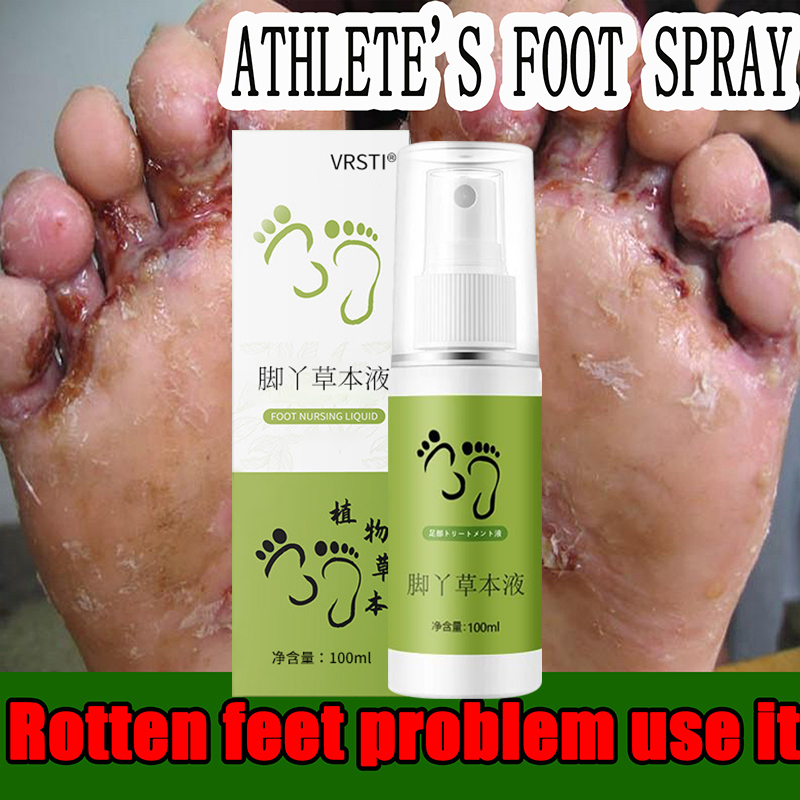 60ML Foot Deodorant Spray For Bad Odor Anti Sweat Anti Odor Spray ...
