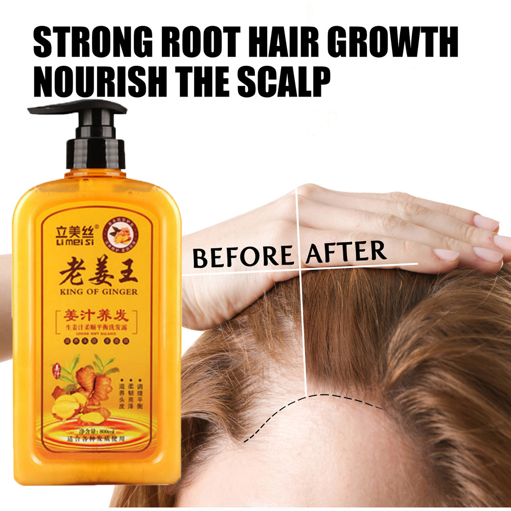 Original Ginger Hair Shampoo Anti Hair Loss Hair Growth Scalp Treatment ...