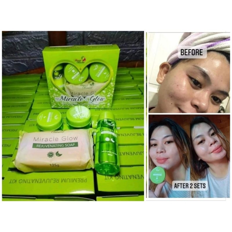 Miracle Glow Premium Rejuvenating Set NEW PACKAGING BRAND :BEAUTY ...