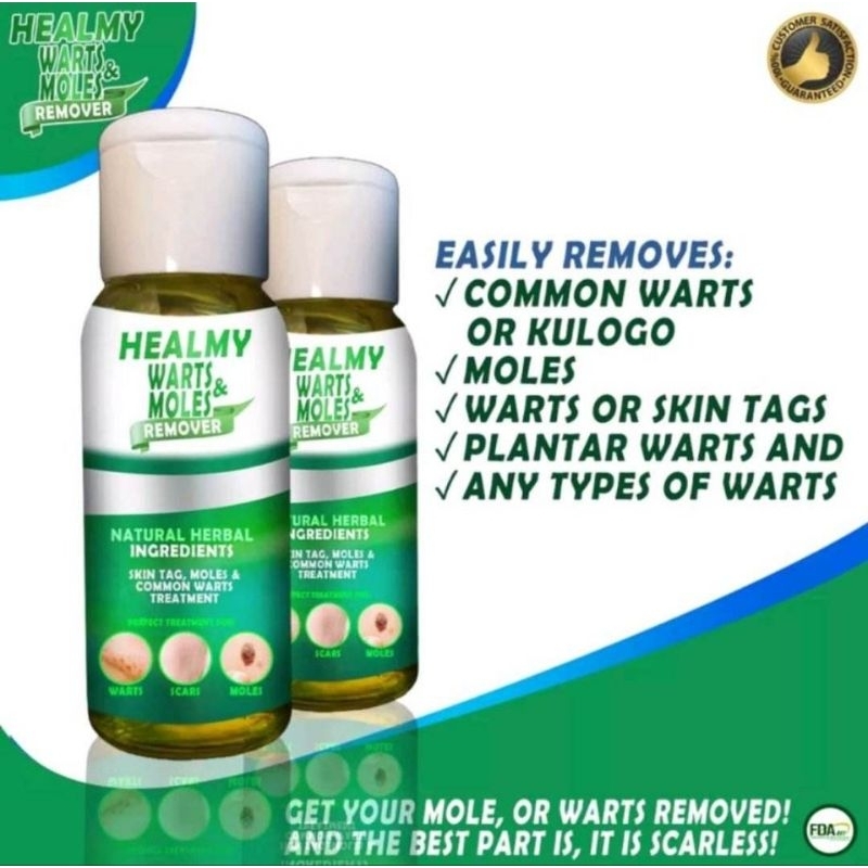 HEAL MY WARTS REMOVER MOLE REMOVER GOODBYE NUNAL | Shopee Philippines