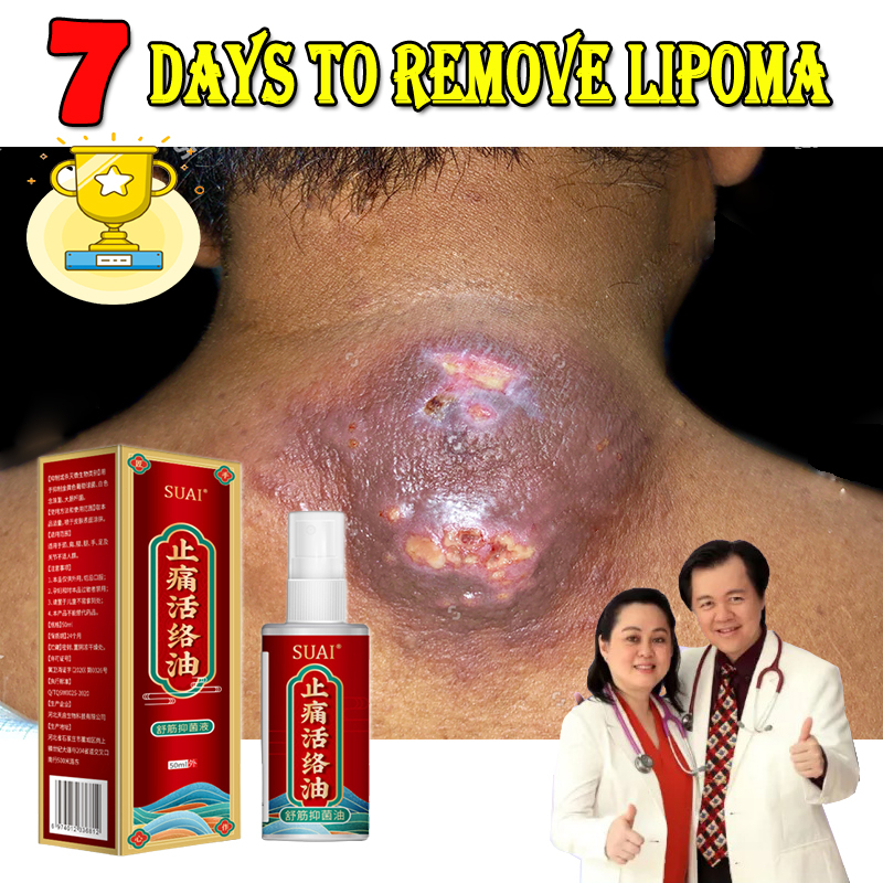 50g ginger cream for bukol sa leeg bukol removal cream lipoma cream 2.0 ...