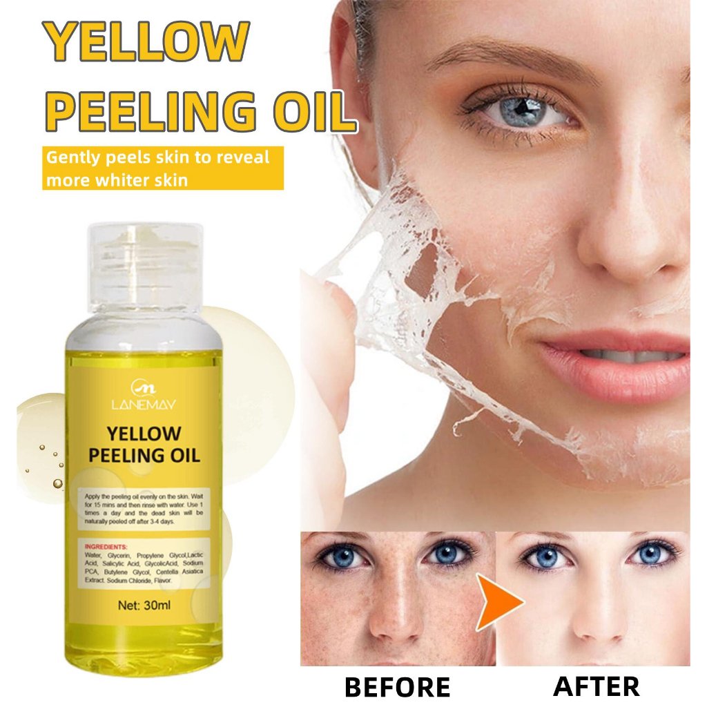 Yellow Peeling Oil Skin Peeling Whitening Body Underarm Deep Clean ...