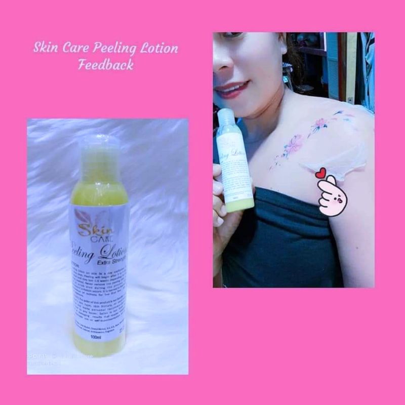 Skin Care Peeling Lotion Extra Strenght 100ml (1 PC) | Shopee Philippines