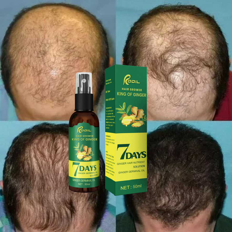 Rodil King Of Ginger Hair Nourishing Oil 7 Days Ginger Germinal Essence