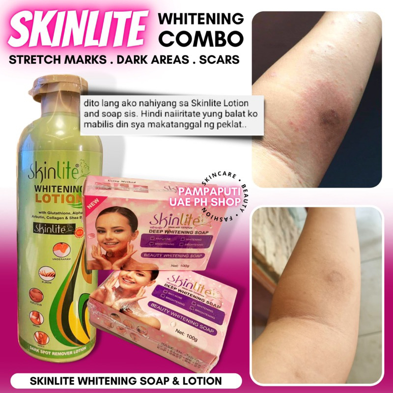 Skinlite whitening Soap and Body lotion | Shopee Philippines