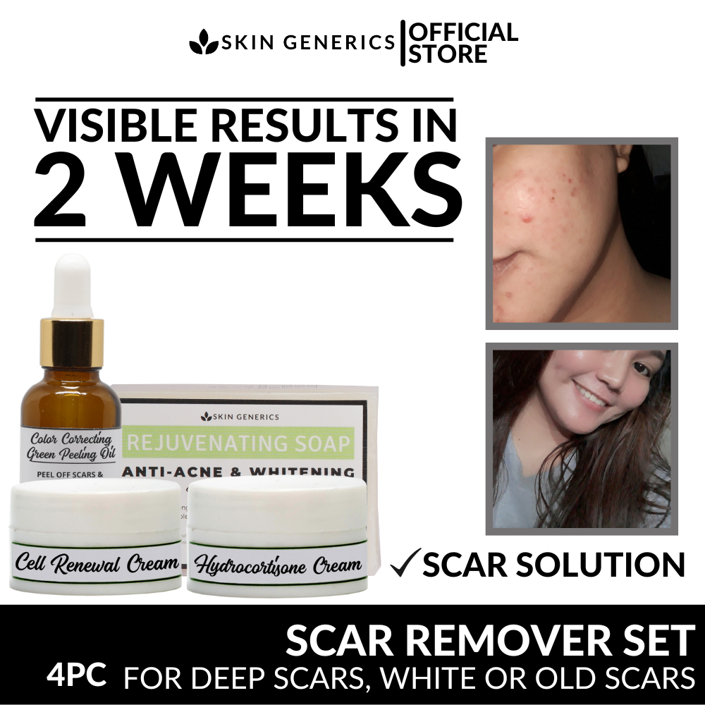 [ SCAR REMOVER ] Skin Generics Scar Remover Set 4 PC Set for Scar ...
