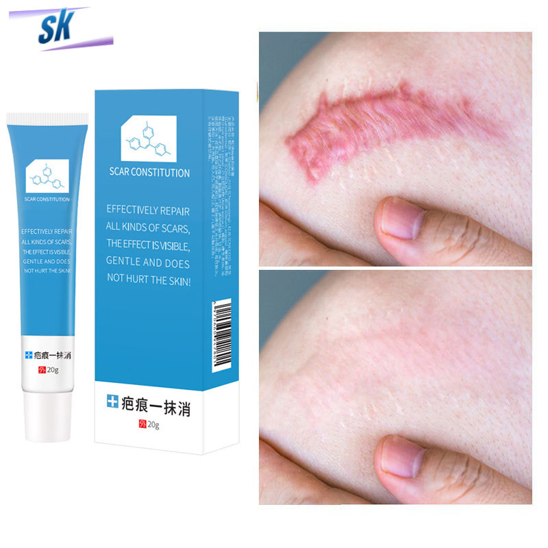 SK Effective Scar Removal Cream Scar Gel Old Scars Acne Scar Treatment ...