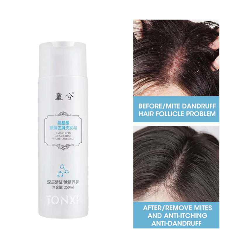 MG Amino Acid Anti Dandruff Mite Removal Hair Shampoo Oil Control Anti Itching Scalp Treatment ...