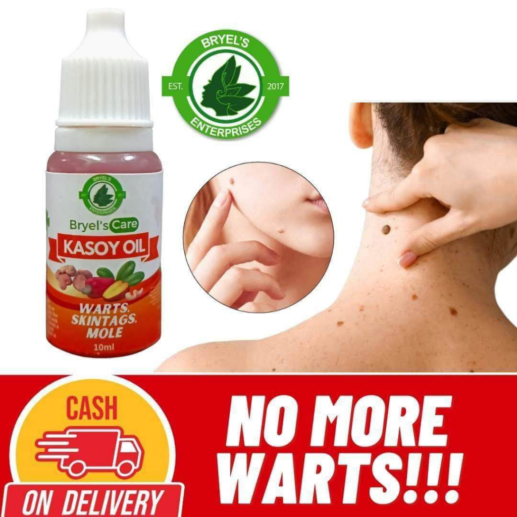 10ml Organic Pure Kasoy Oil Warts Remover Skin Tags Remover, Mole ...