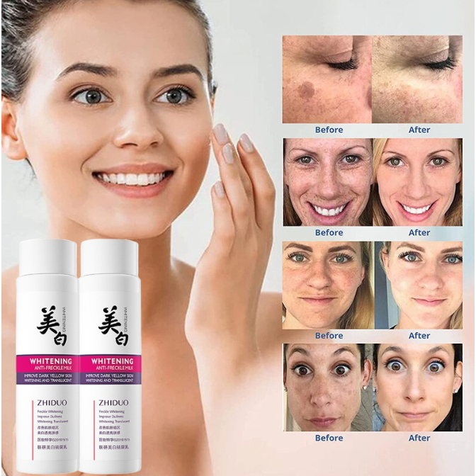 Whitening Freckle-removing Lotion Cream Body Facial Lotion Moisturizing ...